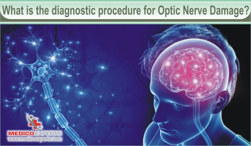 Optic Nerve Regeneration: A New Frontier in Vision Restoration